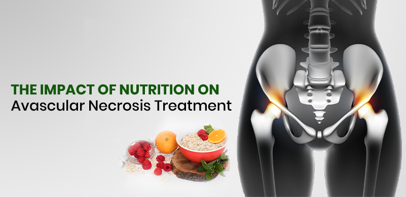 The Importance of a Nutritious Diet in the Avascular Necrosis Treatment